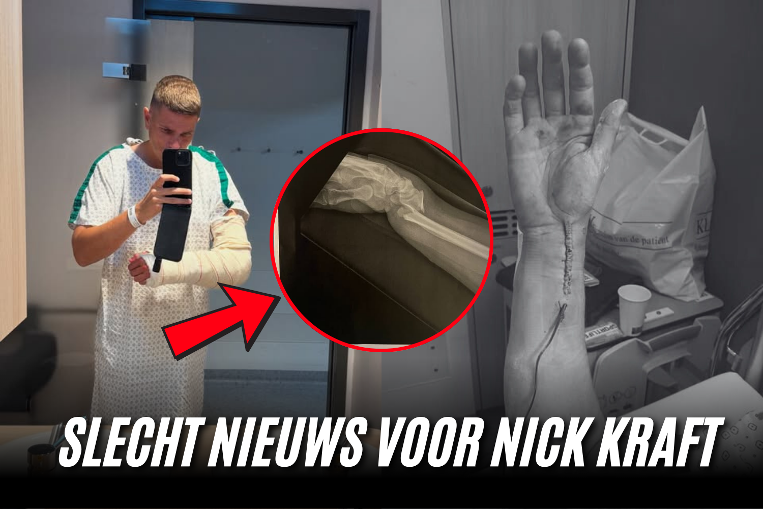SLECHT NIEUWS!! Nick Kraft (de presentator van Big Brother) maakt ...